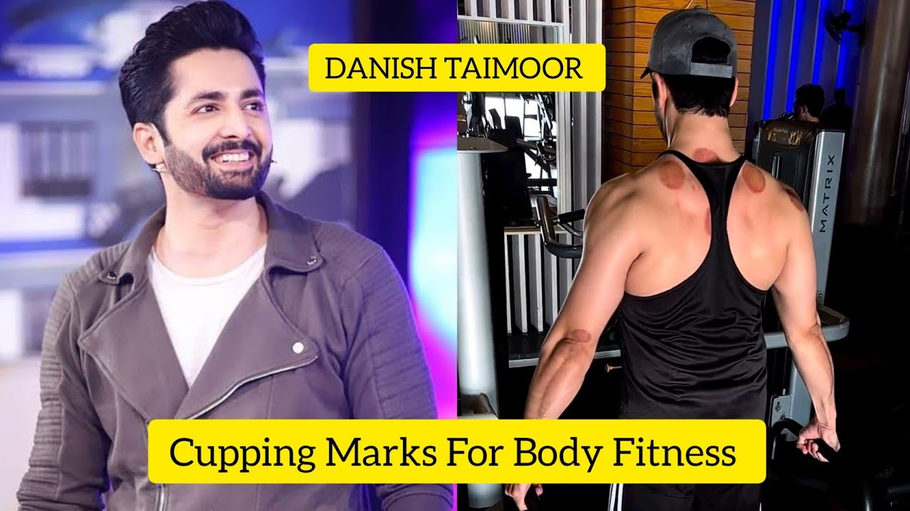 Danish Taimoor - Hijama Cupping Marks For Fitness - YouTube