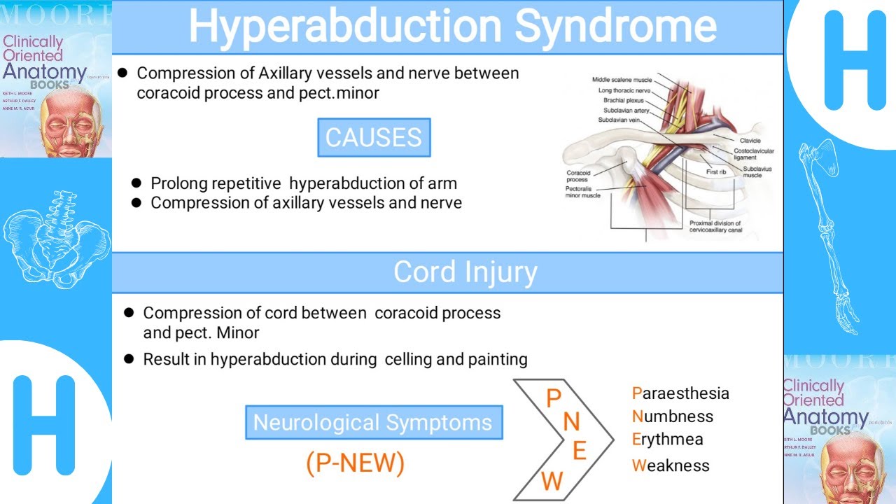Hyperabduction Syndrome||Upper limb clinicals||brief explanation - YouTube