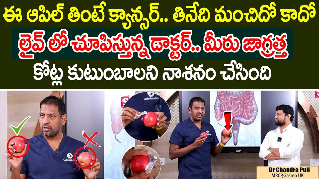 ఈ ఆపిల్ తినడం వల్లే క్యాన్సర్ వచ్చింది..మీరు జాగ్రత్త | Dr. Chandra ...