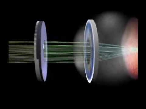 Lasik wave front - YouTube