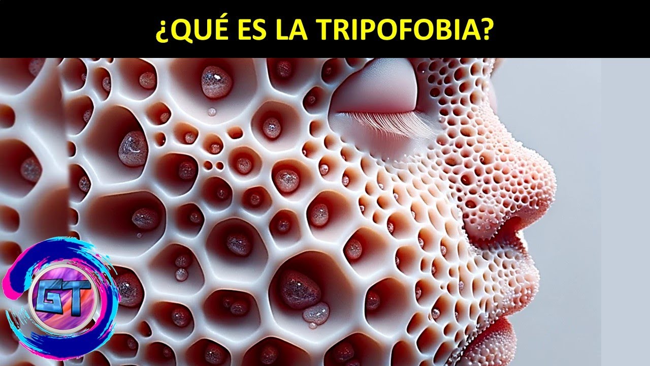 ¿Qué es la Tripofobia? Descubre la Fobia a los Agujeros - YouTube