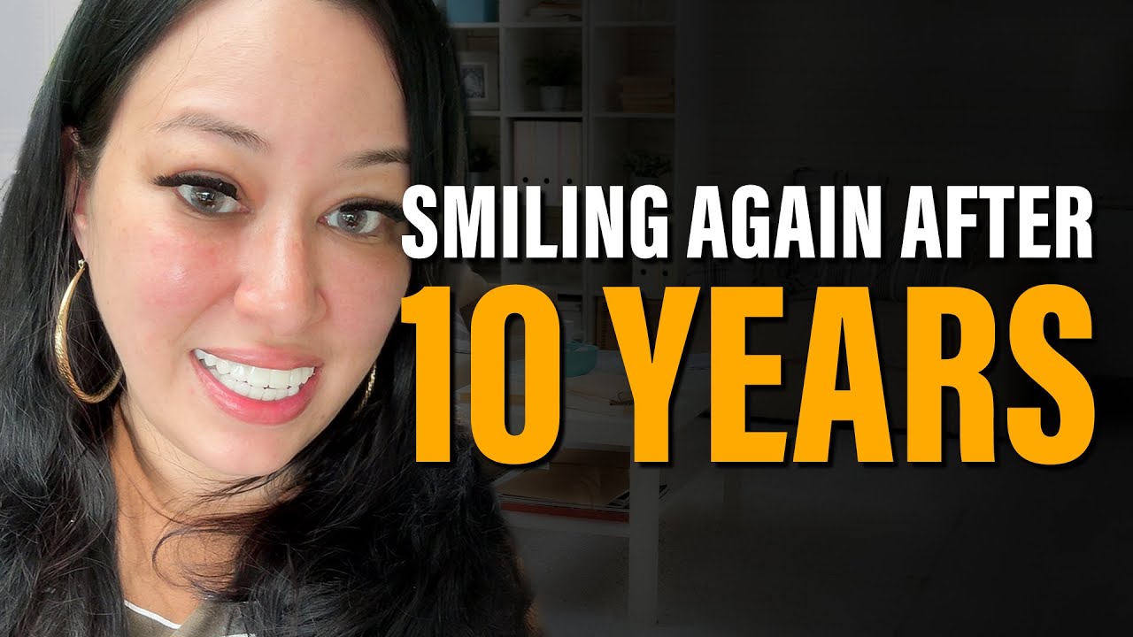 10 Year Bad Smile Struggle Ends with a Snap-on Dental Veneer by ...