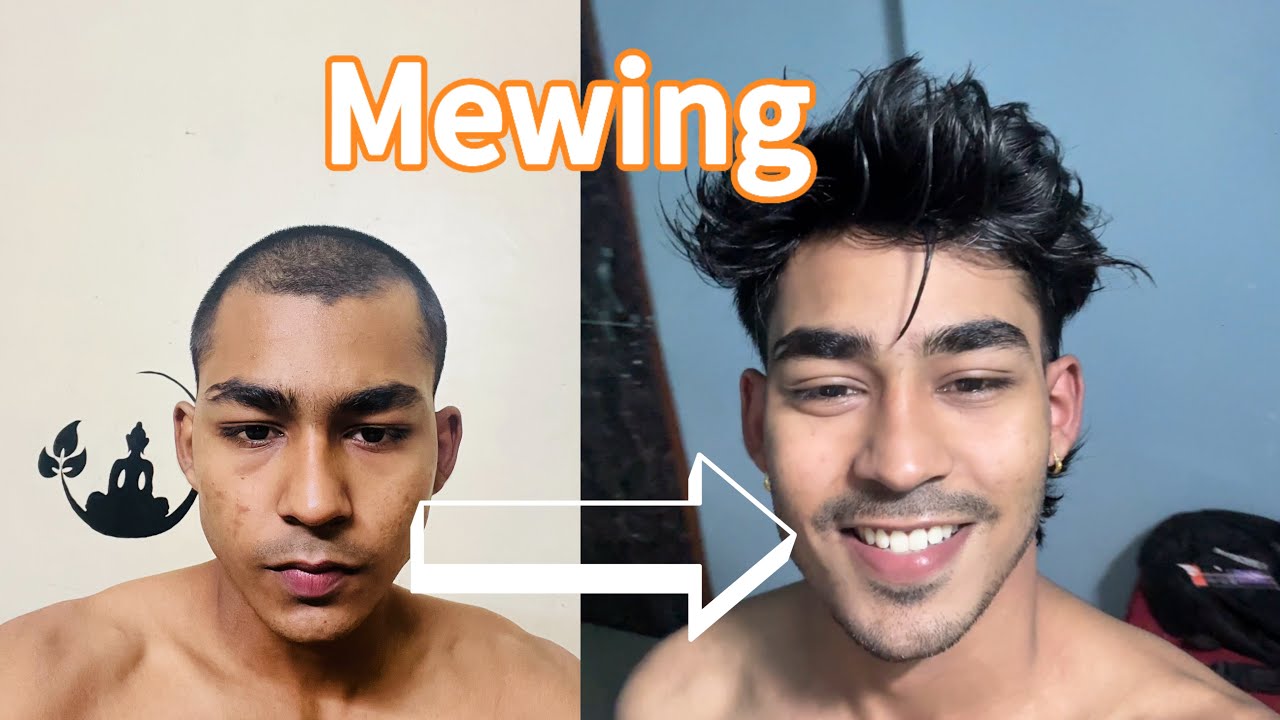 Fix Your Face with Mewing (The RIGHT Way) - YouTube