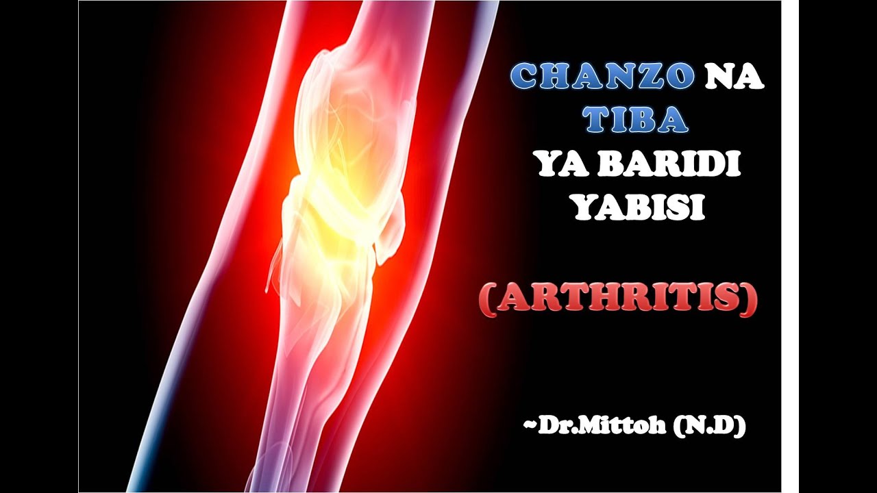 CHANZO NA TIBA YA BARIDI YABISI (ARTHRITIS) | Mittoh_Isaac (N.D) - YouTube