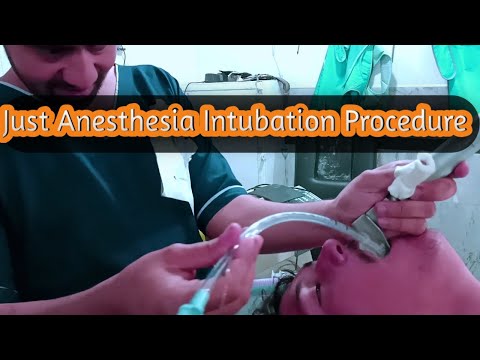 General Anesthesia Intubation Procedure |Just General Anesthesia ...