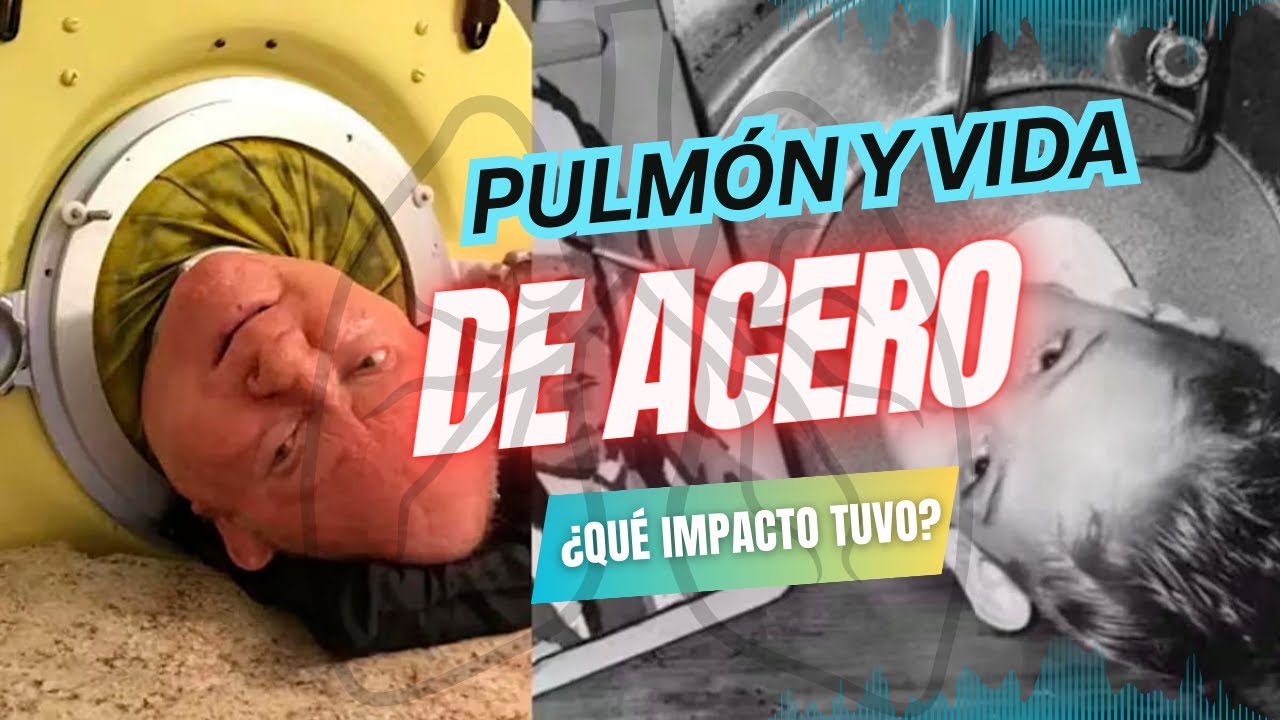 Hombre de acero: la sorprendente vida de Paul Alexander y su pulmón ...