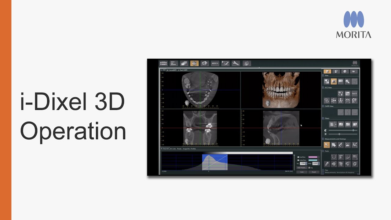 i-Dixel 3D Operation Webinar - YouTube