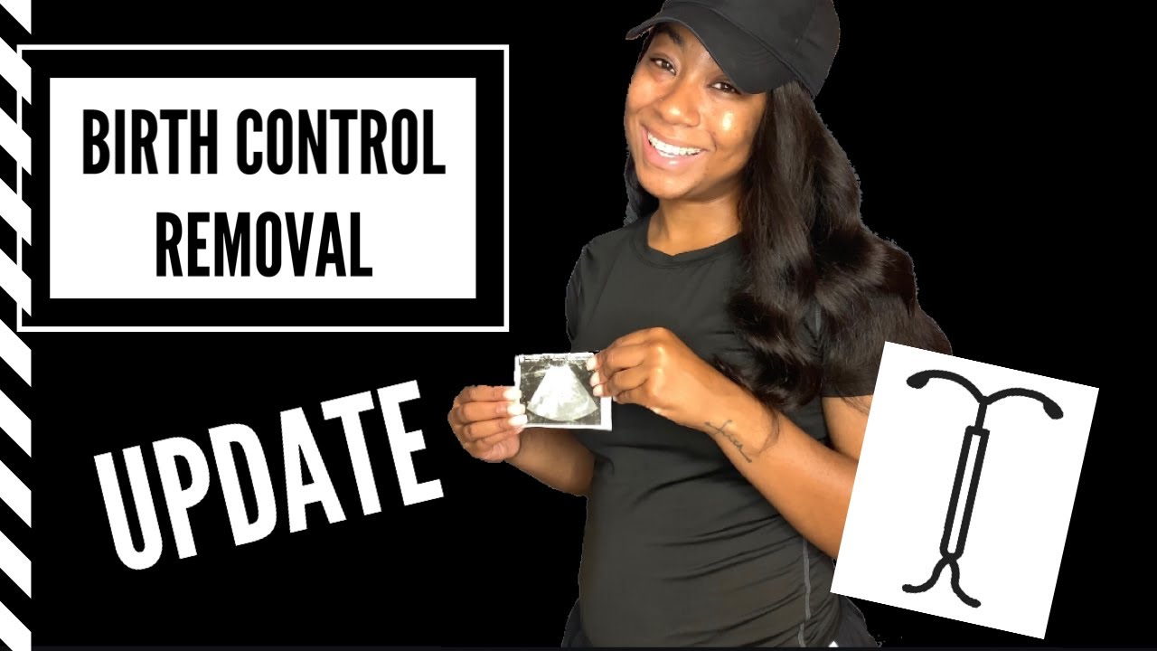 BIRTH CONTROL | Mirena removal update - YouTube