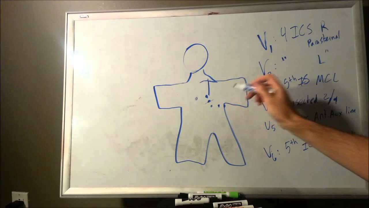 The Precordial Leads: An Introduction - YouTube