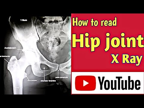 How to read Hip joint X Ray । Hip joint Anatomy । Uday Xray - YouTube