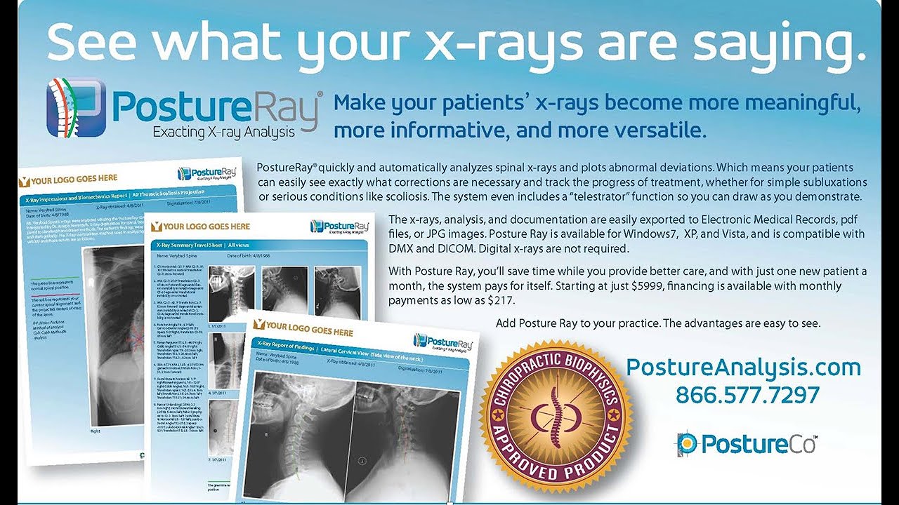 PostureRay Computer Vision Enabled X-Ray EMR - YouTube