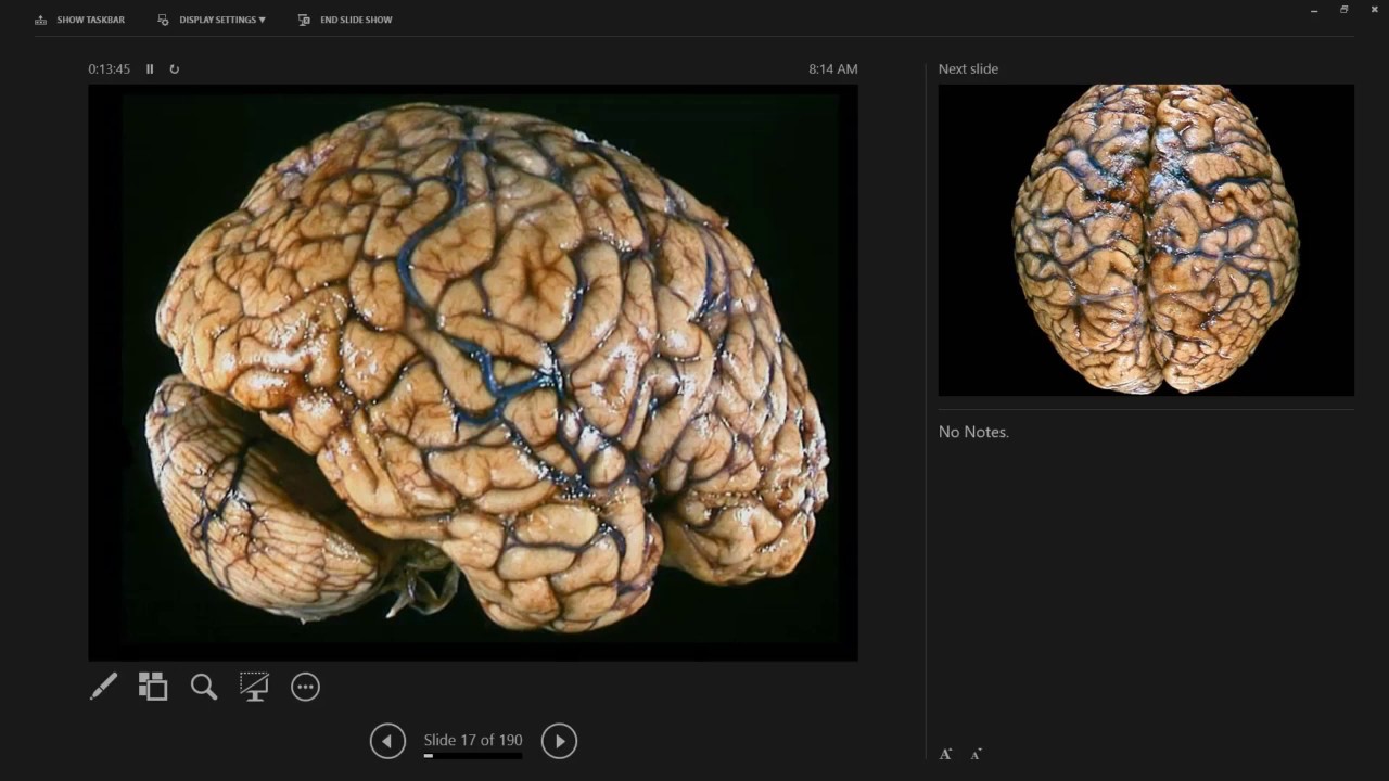 Gross Brain, part 1 - YouTube