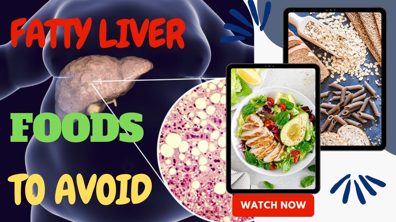 Fatty Foods To Avoid