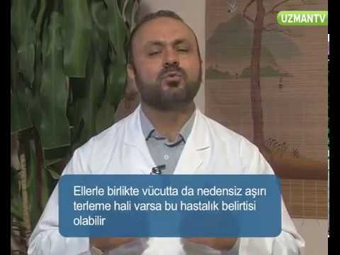 Avuç içi neden terler