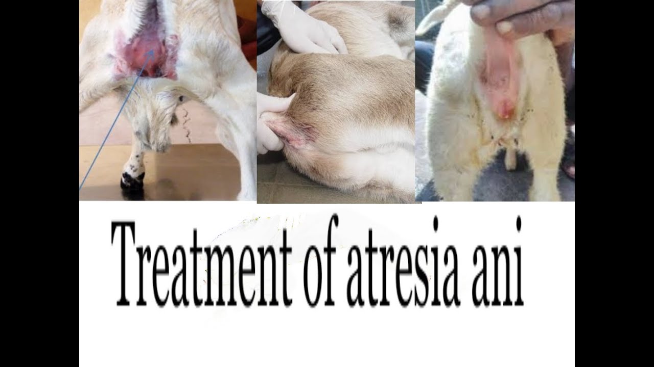 surgical Management of atresia ani - YouTube