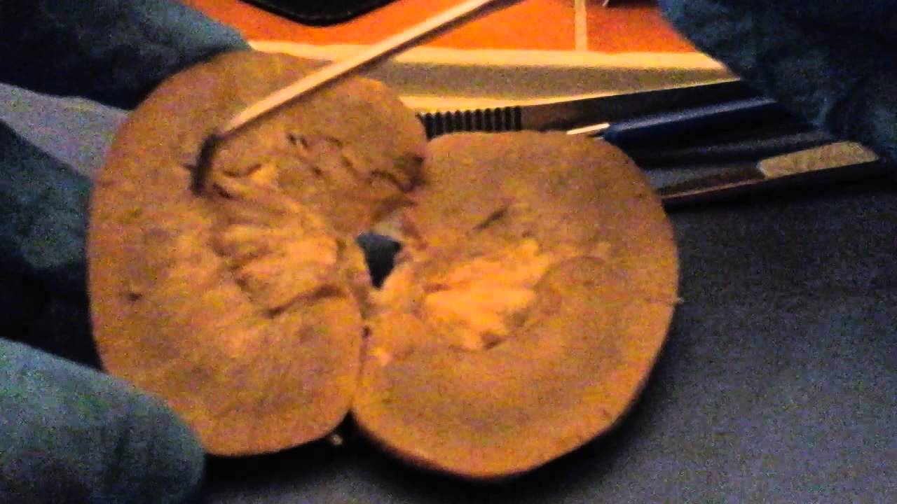 BIO 163 Sheep Kidney Dissection - YouTube