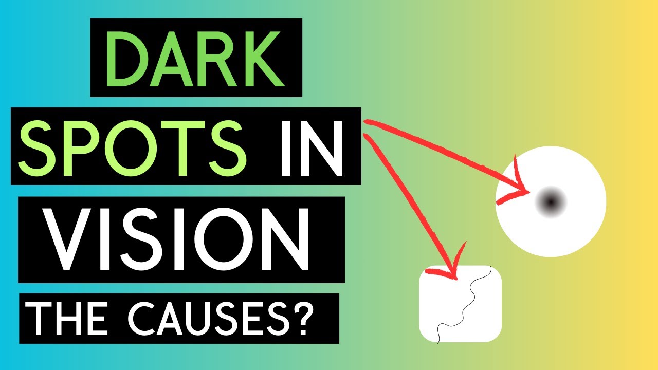 Eye Floaters: The Real Causes of Spots in your Vision - YouTube