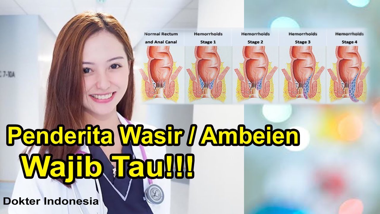 Stadium Keparahan Wasir Yang Benar Menurut Medis - Penderita ambeien ...
