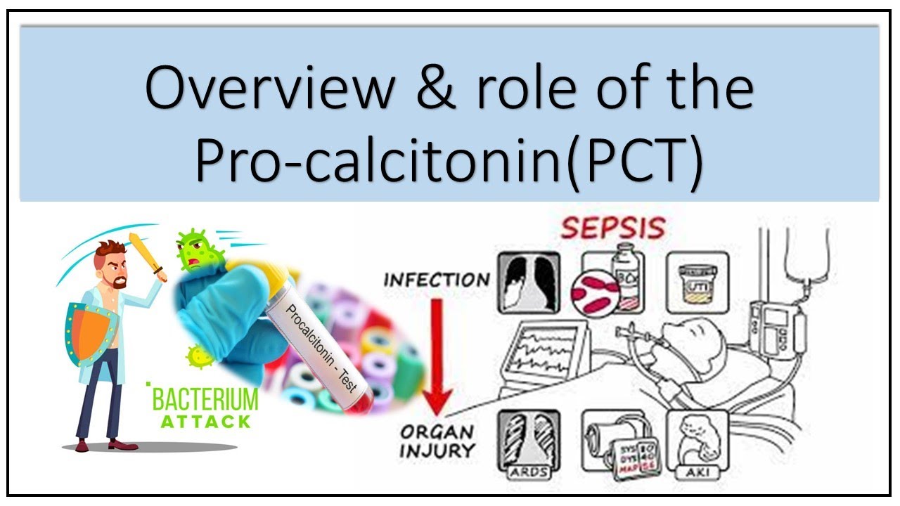 Overview & role of the Procalcitonin.#PCT#Procalcitonin#Hormone#Covid19 ...