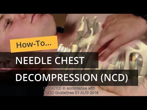 Needle Chest Decompression in TCCC - YouTube