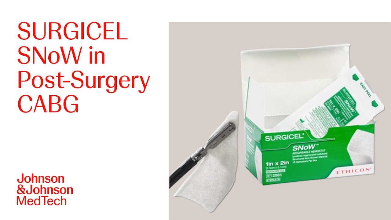 Minimizing Post-Surgery Sternal Edge Bleeding in CABG Procedure | J&J ...