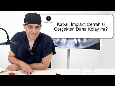 Kapalı İmplant Cerrahisi Gerçekten Daha Kolay mı? | Lazer, Rehberli ve Dikişsiz İmplant