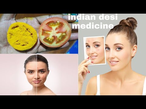 Daag bhabbe kaise htaye,kaale nisaan pimple k daag bahut hi aasan ...