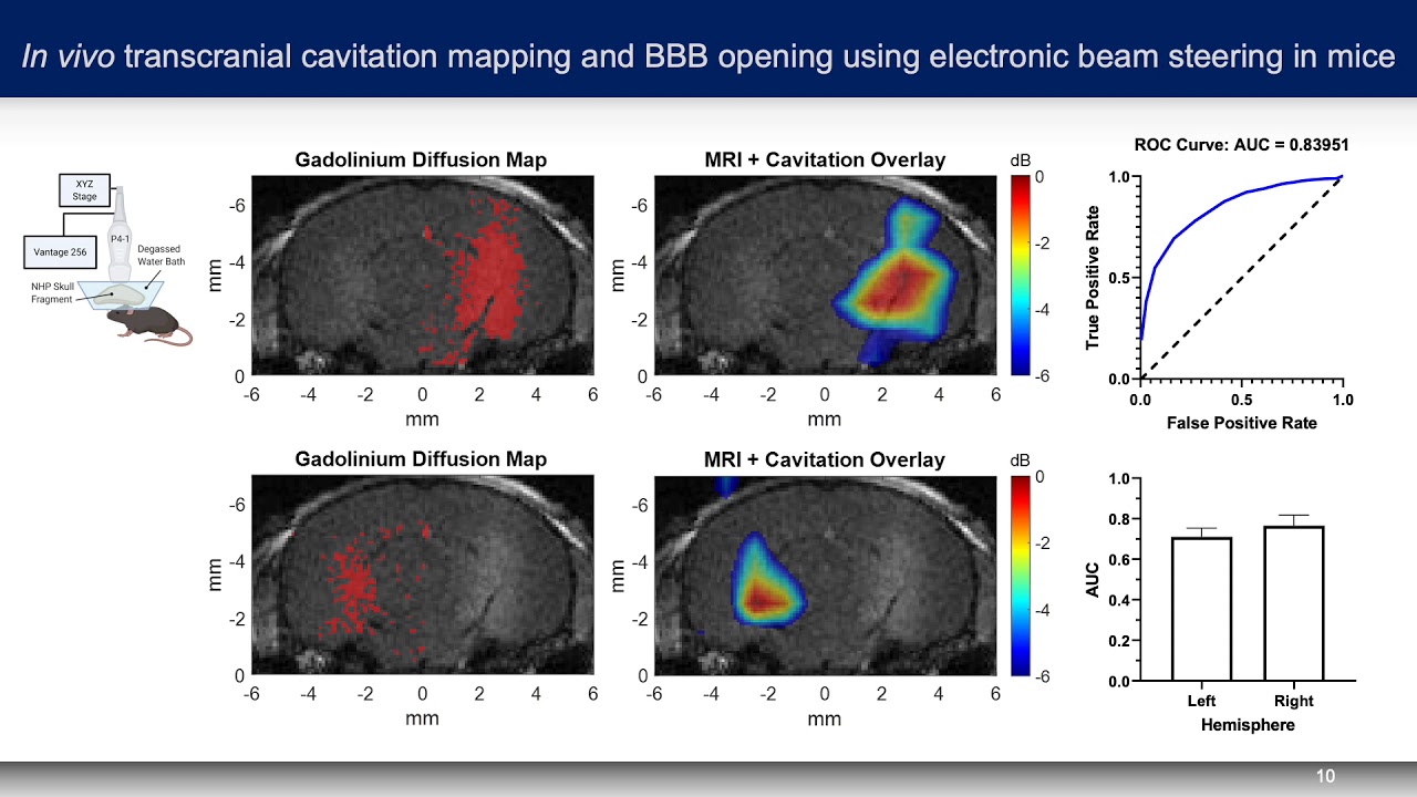 Batts - High Resolution CT-based Preplanning for Transcranial BBB ...