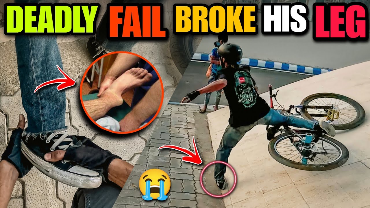 EXTREME STUNT FAIL | Witness the Shocking Leg Break! - YouTube