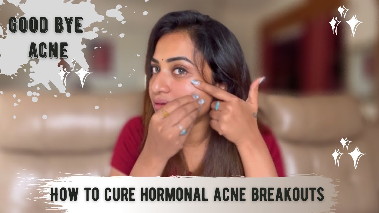 Hormonal Breakouts/ Active Acne ? Here’s the one stop solution | Nua ...