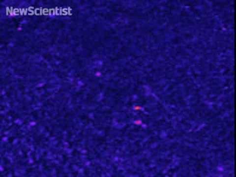 Tiny human brain made in a lab - YouTube