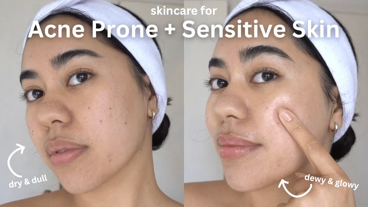 Acne Prone + Sensitive Skincare 🌿 (glowy skin and acne fighting) - YouTube