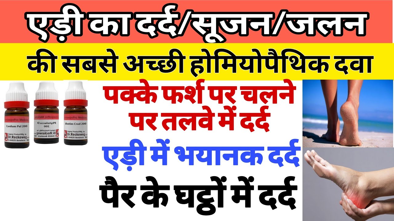 एड़ी में दर्द/सूजन/जलन की होम्योपैथिक दवा!! best homeopathic medicine ...