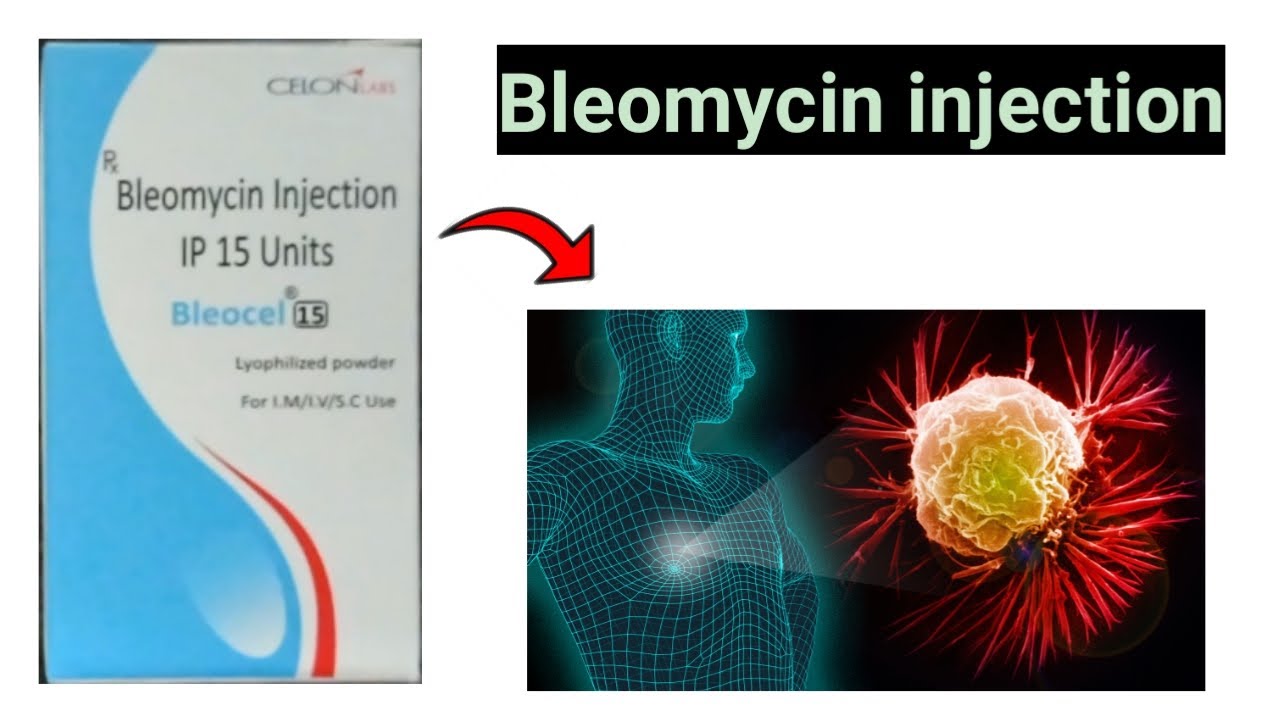 Bleomycin injection ip 15 units - YouTube