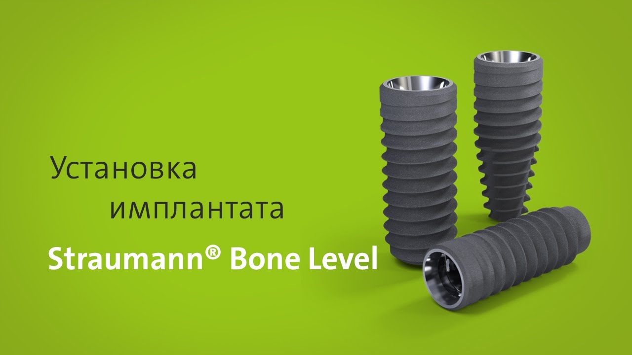 Установка имплантата: Straumann® Bone Level - YouTube