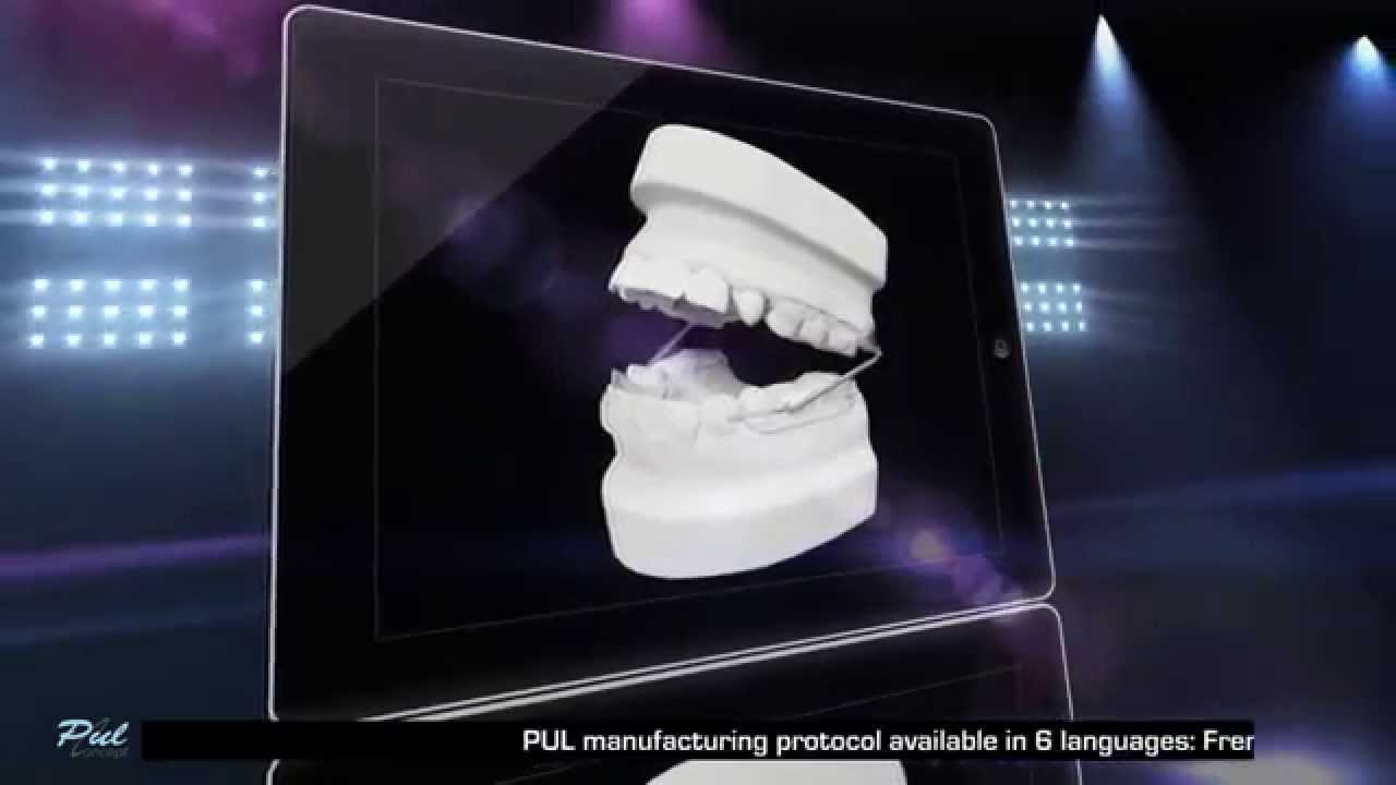 Ortho Solutions - Teaser PUL Concept - YouTube
