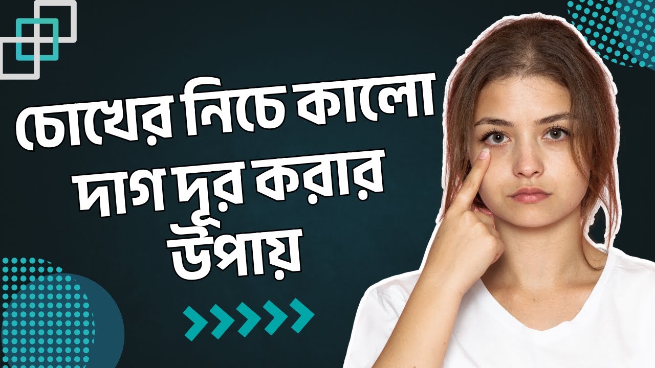 চোখের নিচে কালো দাগ দূর করার উপায় | chokher niche kalo dag dur korar ...
