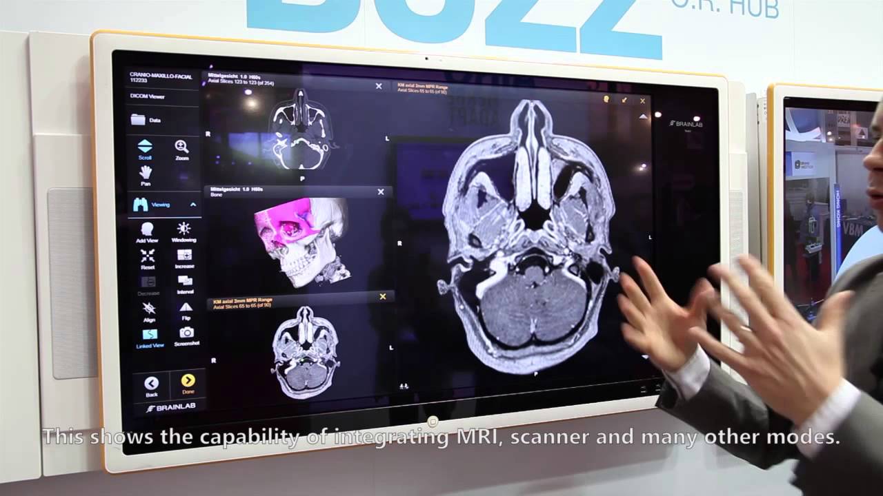 MedicalExpo: Brainlab (BUZZ) at Arab Health 2014 - YouTube