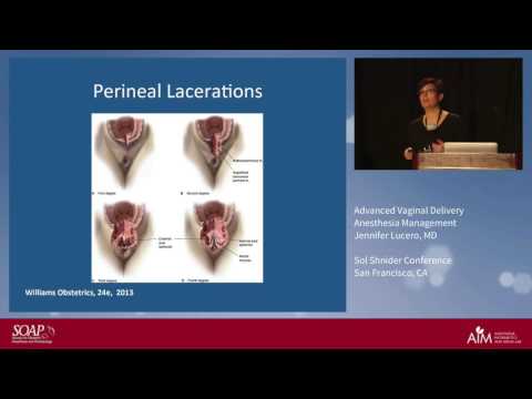 Advanced Vaginal Delivery Anesthesia Management Jennifer Lucero, M.D.