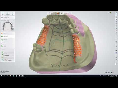 Partial Framework Designㆍ61(YG Dental Lab) - YouTube
