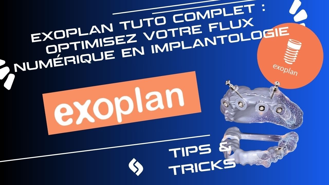 Exoplan Tuto Complet : Optimisez Votre Flux Numérique en Implantologie ...