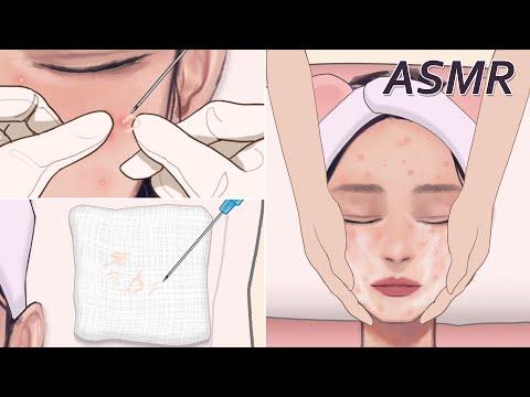 ASMR | Acne Removal Skin Care | スキンケア | 여드름 피부 관리 | 皮膚管理清痘痘粉刺做臉 | DADA ASMR