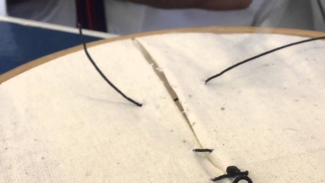 Sutura de Sarnoff - YouTube