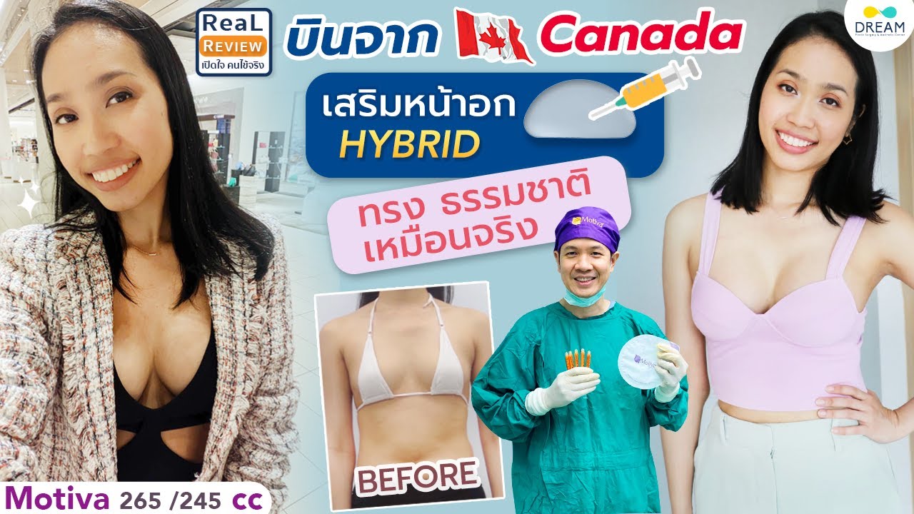 [Dream]รีวิวเสริมหน้าอก Hybrid ซิลิโคน Motiva 250 cc พอดีตัวที่สุด - YouTube