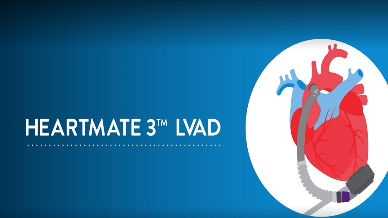 How the HeartMate 3 Left Ventricular Assist Device (LVAD) System Works ...