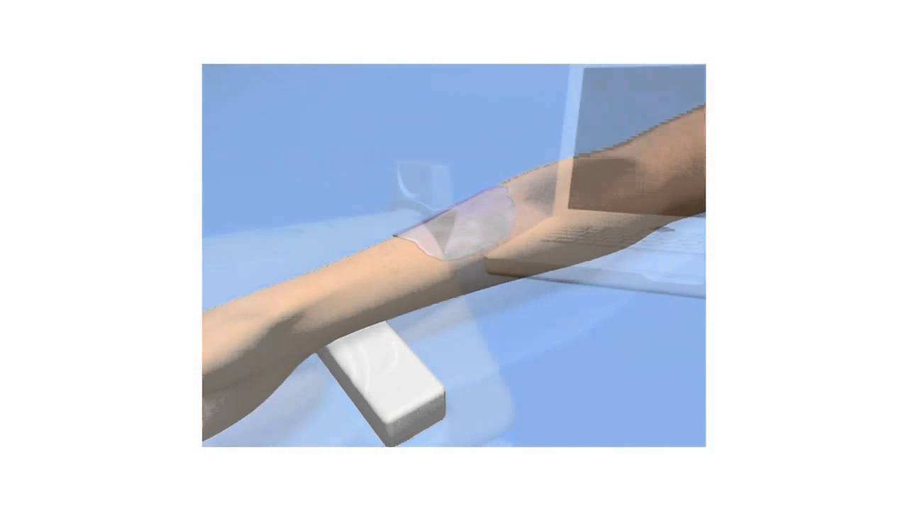 Sunlight MiniOmni - Bone Density Test - Simple, Fast and Easy! - YouTube