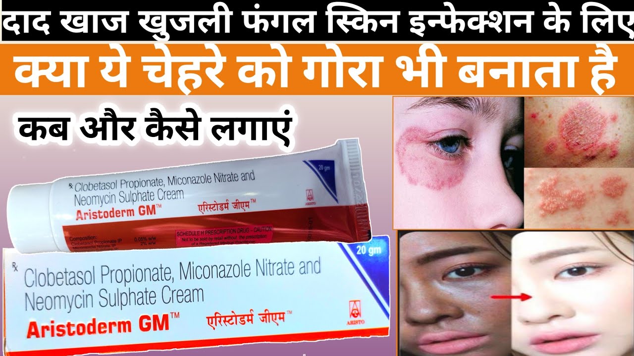 Aristoderm gm cream | zincoderm gm cream | fourderm cream | quadriderm ...