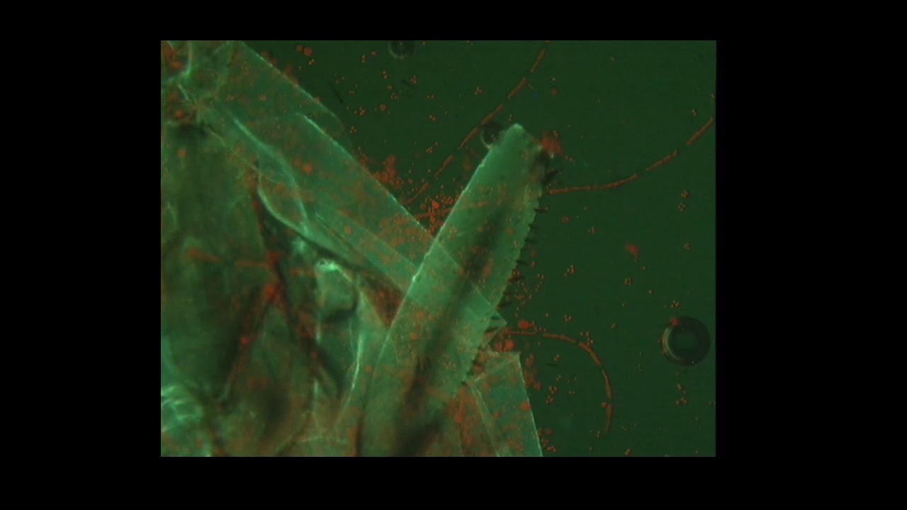 Exploring a dead microscopic insect with a fluorescent epi-illuminator ...