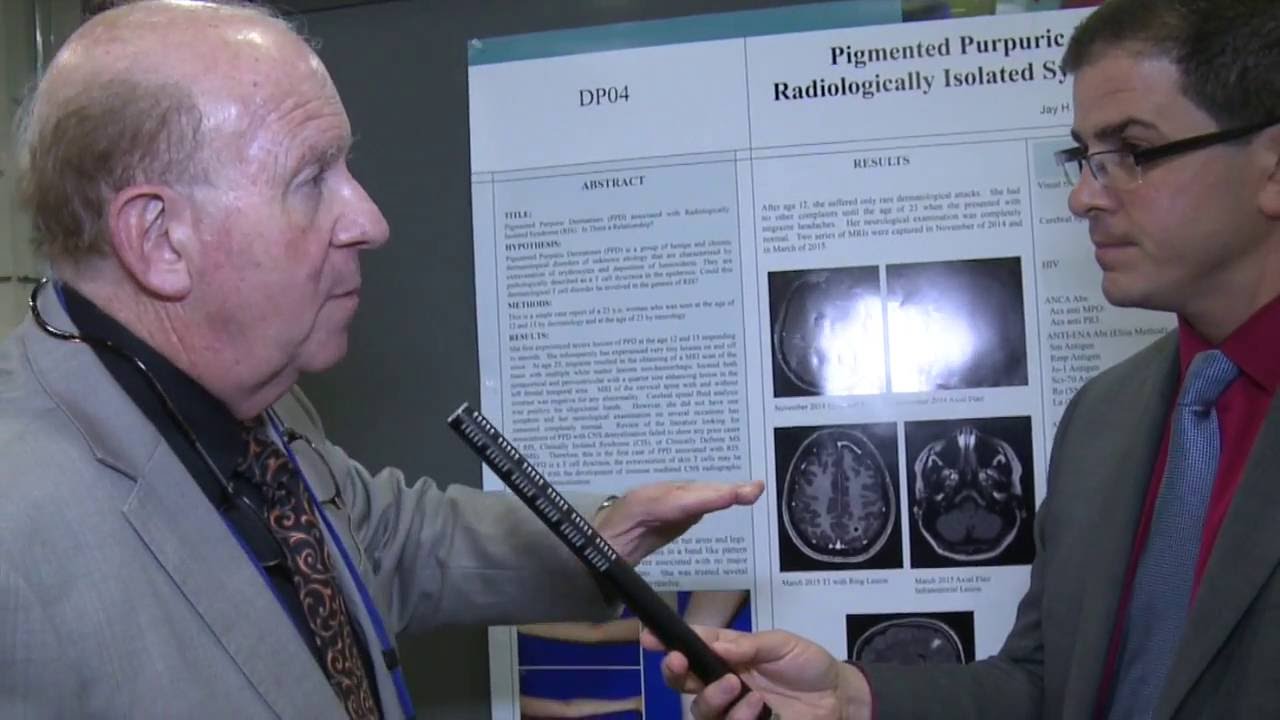 Pigmented Purpuric Dermatosis (PPD) and Radiologically Isolated ...