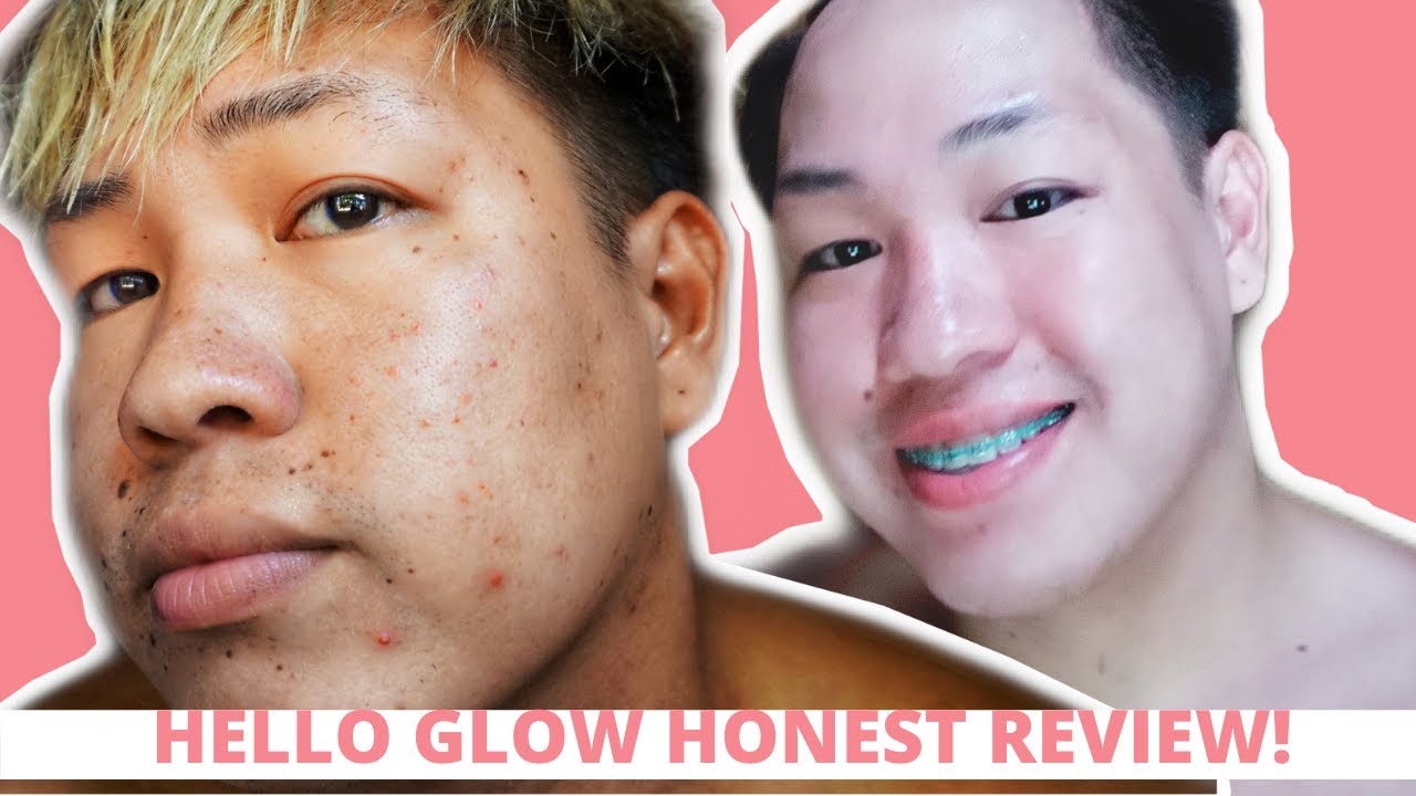 HELLO GLOW ALL NATURAL WHITENING SET HONEST REVIEW IN 23 DAYS - YouTube